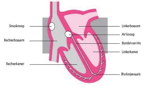 Pijn op de borst: Angina Pectoris