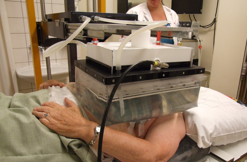 Hyperthermie en bestraling bij teruggekeerde borstkanker | Amsterdam UMC