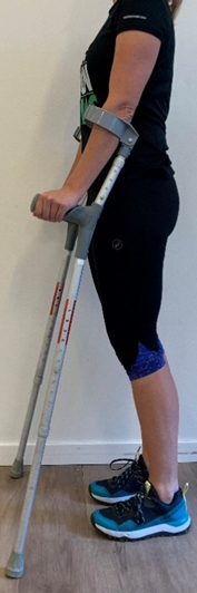 Verzwikking van de enkel