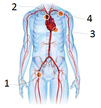 Transkatheteraortaklepimplantatie, Transkatheter Aortic Valve ...