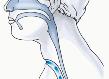 Laryngectomie: verwijderen van het strottenhoofd