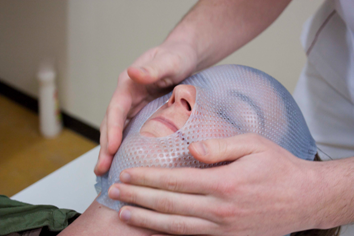 Huidkanker en bestraling (radiotherapie)