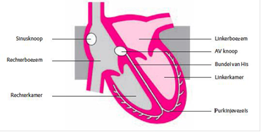 Pulmonalisklepstenose | Amsterdam UMC