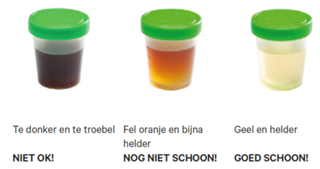 Dunne darm onderzoek met een endoscoop