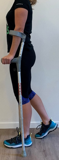 Verzwikking van de enkel