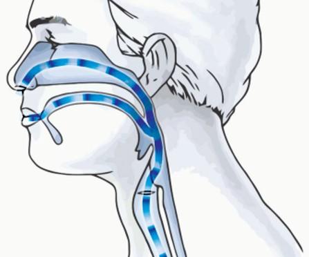 Laryngectomie: verwijderen van het strottenhoofd