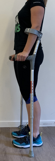 Verzwikking van de enkel