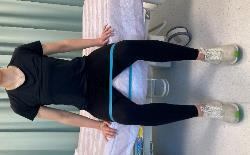 Een gebroken bekken, behandeling met of zonder operatie | Amsterdam UMC