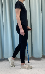 Een gebroken heup, behandeling met operatie