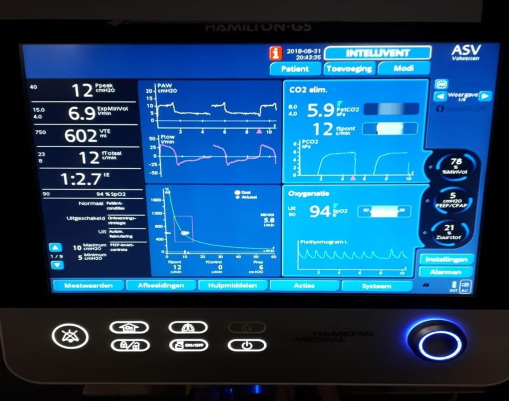 Beademing,informatie voor familie/naasten van de patiënt op de ...
