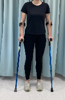 Een gebroken bekken, behandeling met of zonder operatie