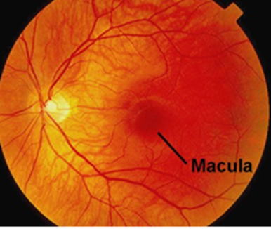 Serosa/centrale sereuze chorioretinopathie (CSC)