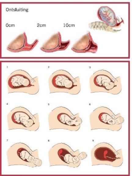 Inleiden van de bevalling | Amsterdam UMC