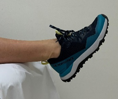 Verzwikking van de enkel