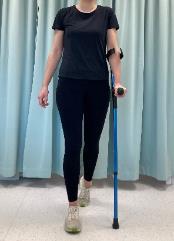 Een gebroken heup, behandeling met operatie