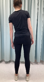 Een gebroken bekken, behandeling met of zonder operatie