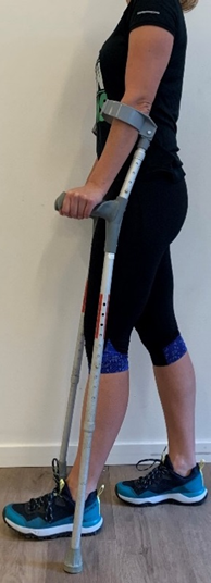 Verzwikking van de enkel