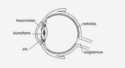 Staar (cataract en staaroperatie bij volwassenen)
